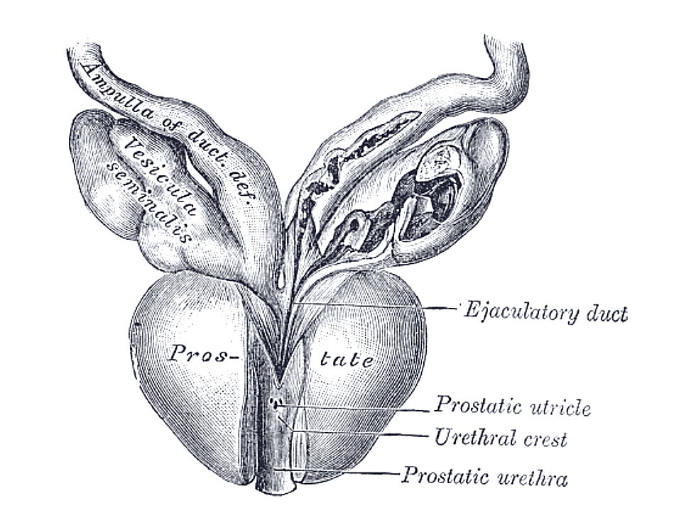 12 Core Prostate Biopsy How To Sample Under Ultrasound Guidance ...